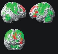 Lie-detection via fMRI: mind-reading or coercion? - Boing Boing