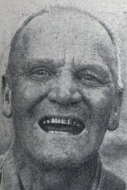 Homemade stainless steel dentures - Boing Boing